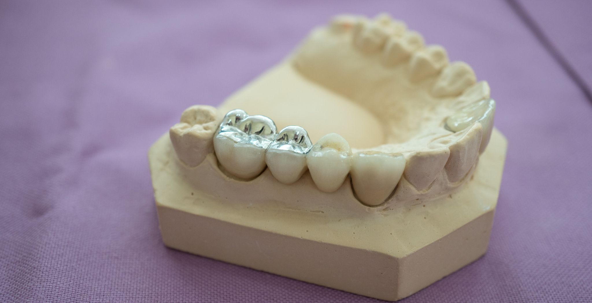 Tooth Filling: Types, Procedure, and Aftercare Tips - Brunswick Dental ...